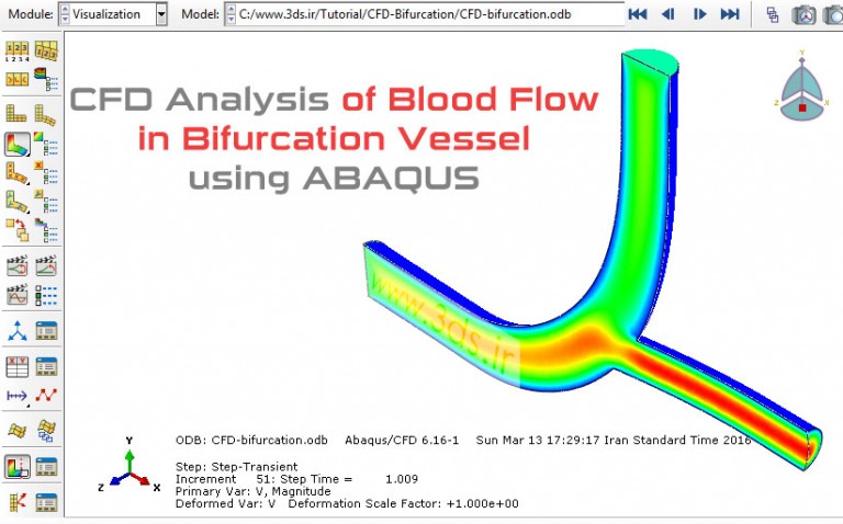 تحلیل CFD جریان خون در مجرای دوراهی رگ توسط آباکوس